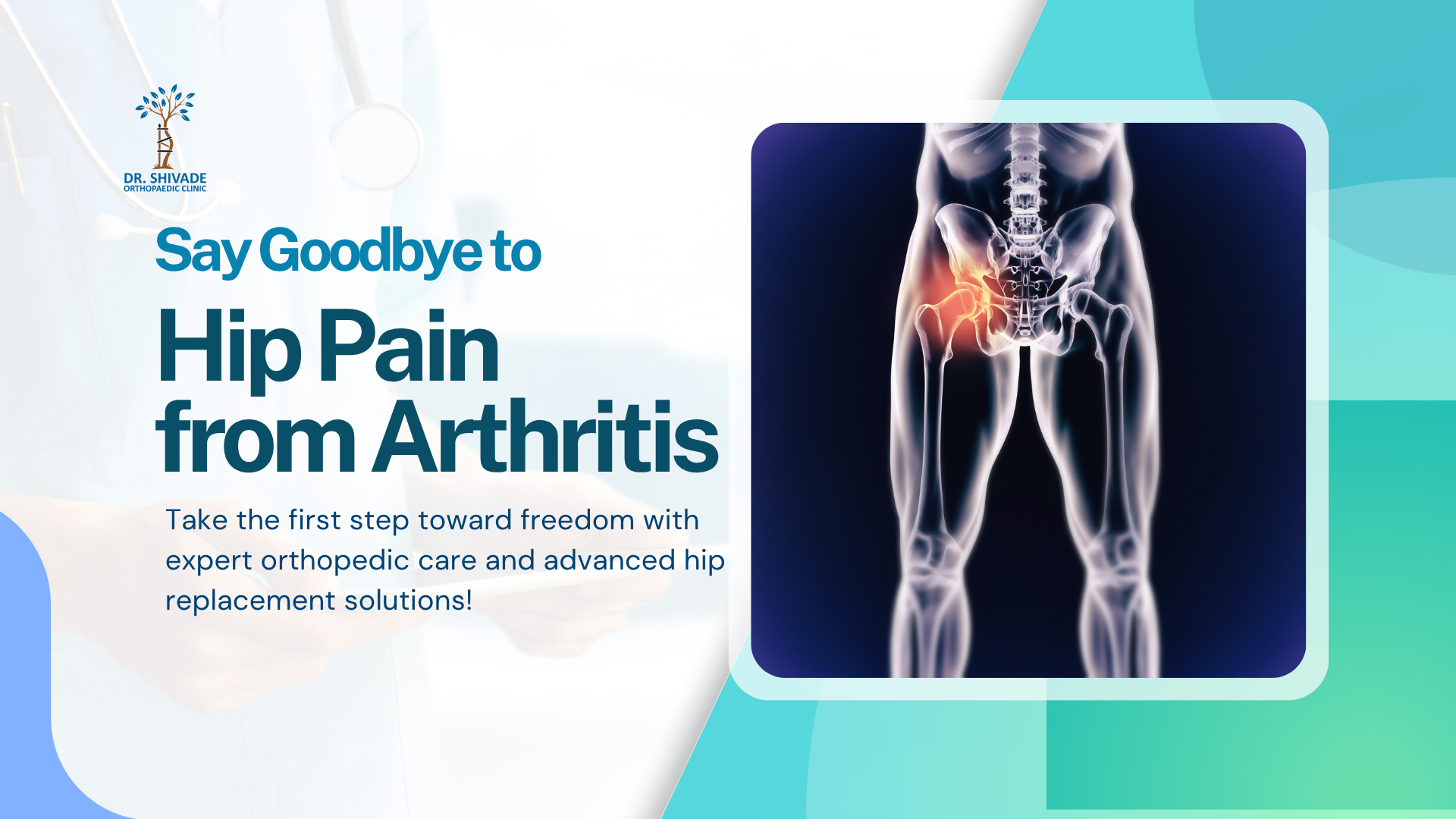 Fractures & Complex Trauma : Complete Guide to Injury, Treatment, and ...